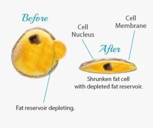 Bodcor's Fat Cell Shrinking Technology | How It Works